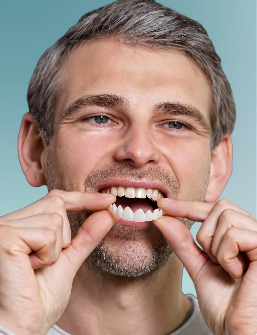 Veneera™ Teeth-Veneer | Smile just leveled up – Veneera™ US